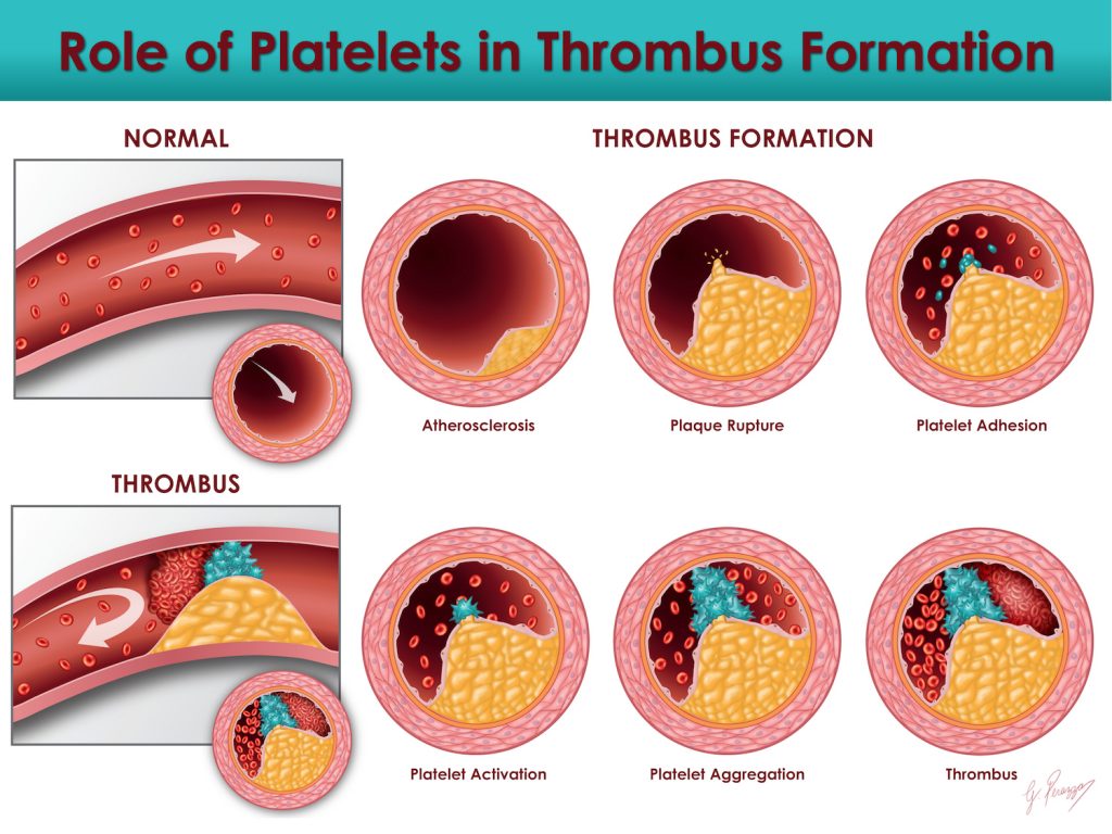 Role of Platelets | Digital Evidence Group